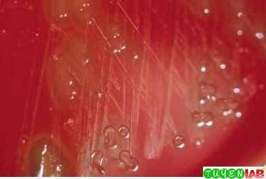Streptococcus Pneumoniae Colony Morphology