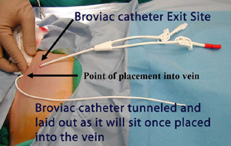 Our Beautiful Family: TPN???