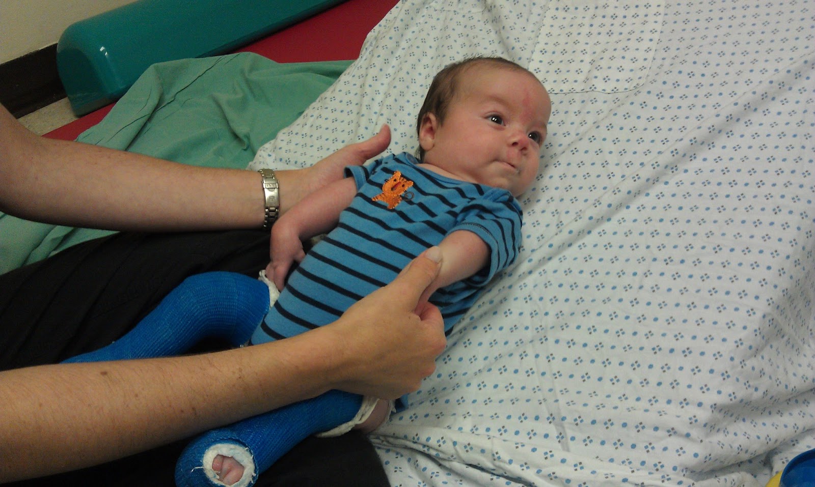 Hope for Arthrogryposis: An Early Intervention