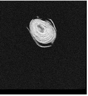 MRI Images of Fruits & Veggies by Andy Ellison | Life in Pictures