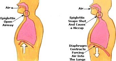 Scientific Reason Behind Hiccups ~ Science and Technology