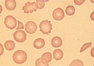 BIOMETRIA HEMATICA: Aprende Sobre Biometria Hematica