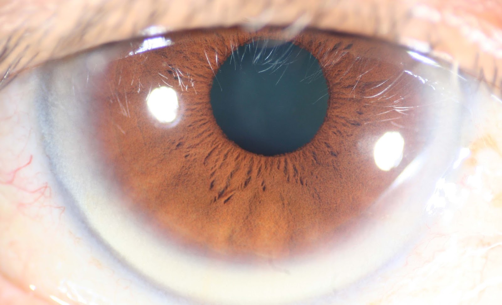 Modern & Multidimensional Iridology: Pupil, Crypts & Integrity of the ...