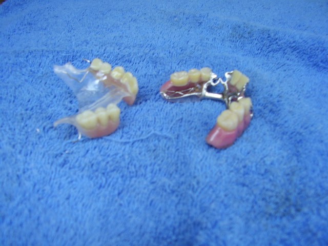 CS Prótese Dentária: PPR e PPR provisória