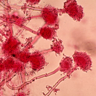 Sustainable Mycology: Aspergillus terreus