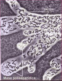 Microbiología: Pseudomonas