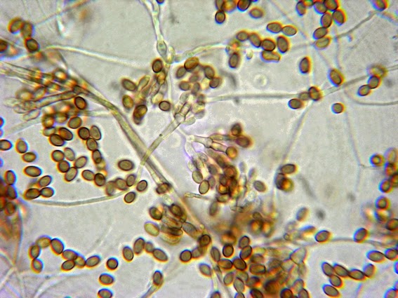 Fun With Microbiology (What's Buggin' You?): Scopulariopsis brumptii