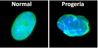 PROGERIA, IMPLICACIONES SOCIALES Y MEDICAS ~ Reproducción celular y técnicas de manipulación del ADN