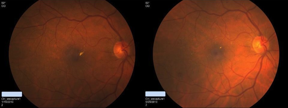 FUNdus exams