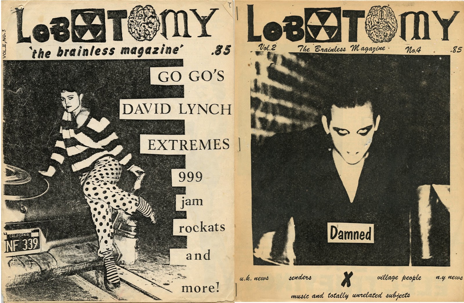 A Brief History of Lobotomy the Brainless Magazine