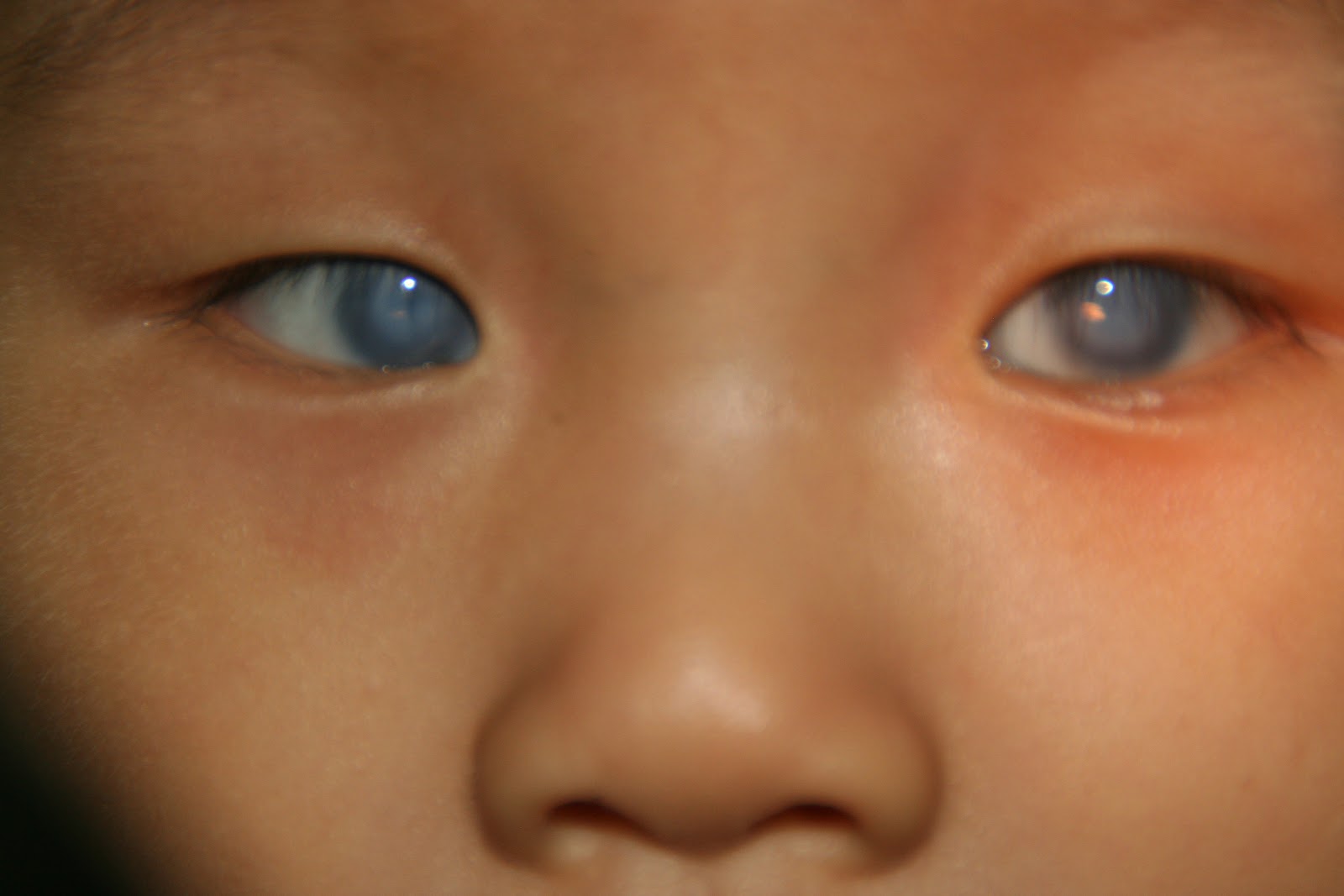 Vietnamese American Ophthalmology Symposium