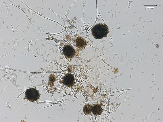 Fun With Microbiology (What's Buggin' You?): Eurotium herbariorum ...
