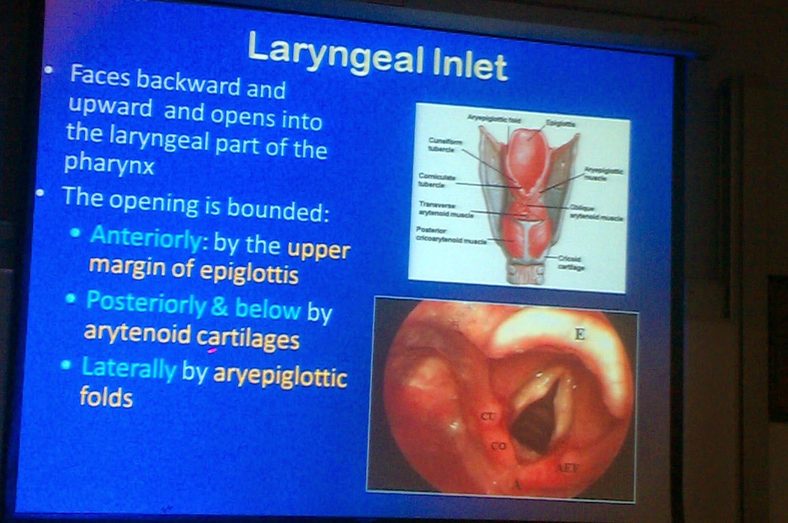 Lecture Slides; ENT: The Larynx