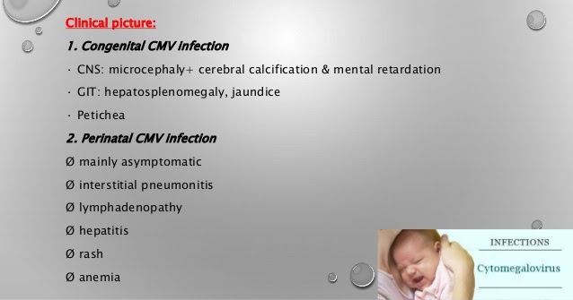 Pediatrics Notes: Congenital and Perinatal Cytomegalovirus Infection