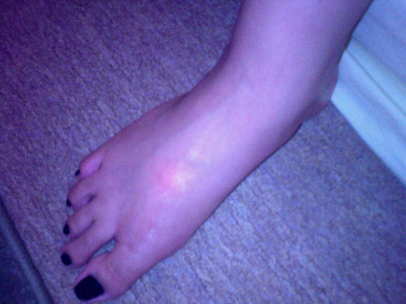 sugat - philippin news collections