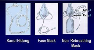 Tikus Kampung Online: S.O.P INHALASI OKSIGEN MELALUI NASAL KANUL DAN ...