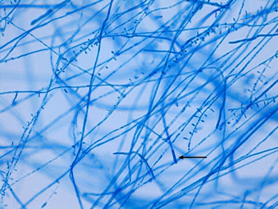 Fun With Microbiology (What's Buggin' You?): Trichophyton tonsurans