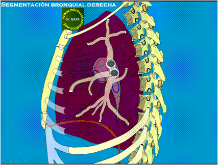 Microbiología JMHB: Bronquitis