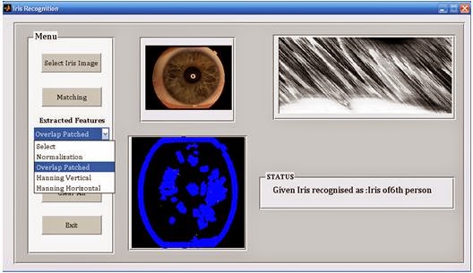 Matlab Code For Dct Based Iris Feature Extraction And Recognition