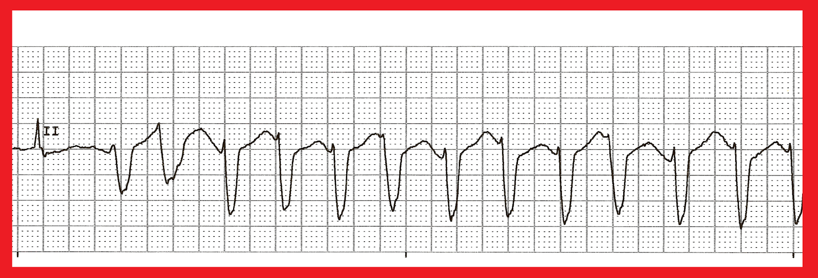 Practice EKG Strips 341