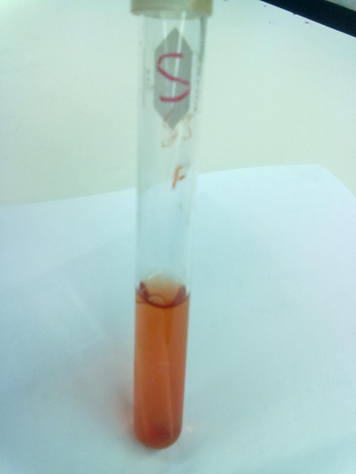 Samantha and Sarah's Microbiology Lab Journal: The Results! Gelatin and ...
