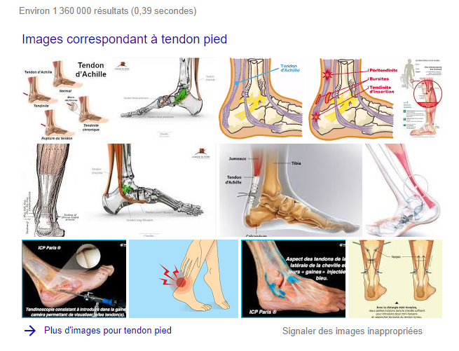 TENDON DU PIED G/douleur