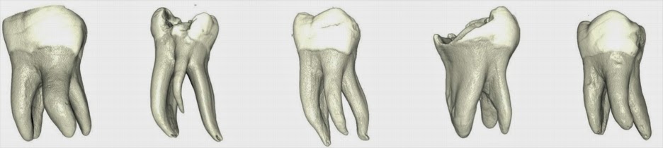 The Root Canal Anatomy Project: JOE Publication: Radix