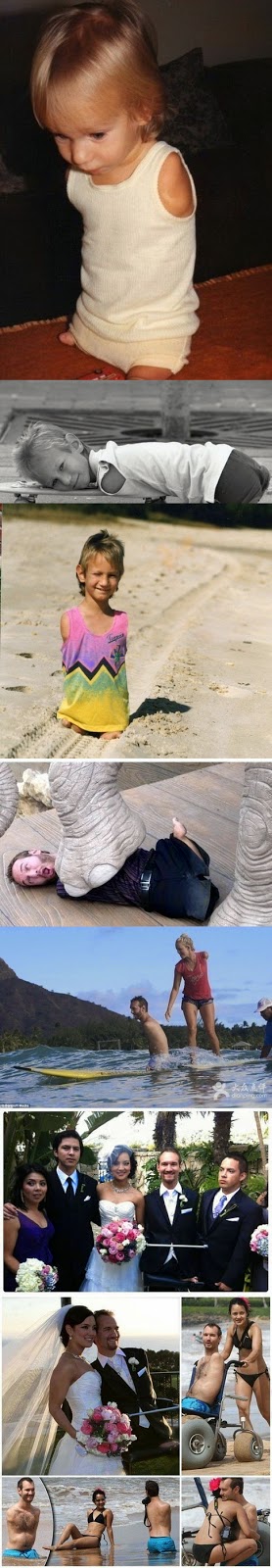 Very famous disabled person, Born with no Legs, No hands But has a ...