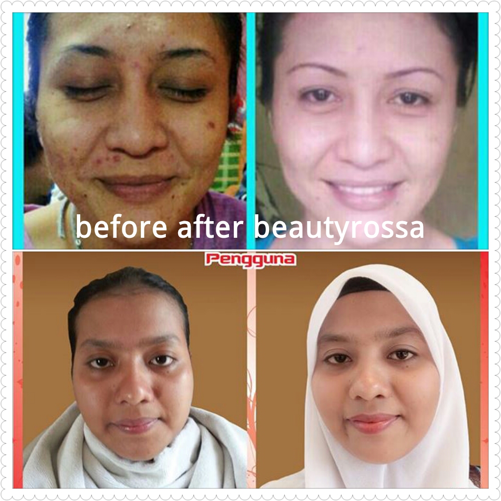 Testimoni Pengguna Beauty Rossa | Beauty Rossa BB D1845899 ...
