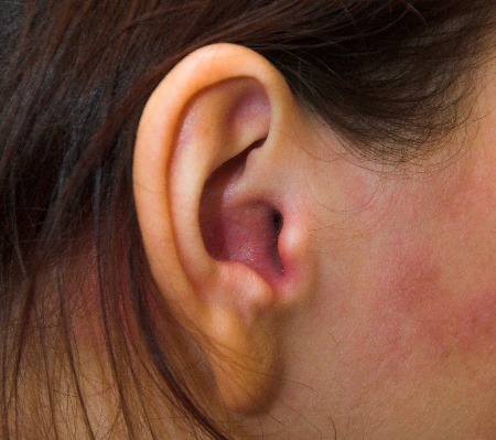 دُمل الأذن الخارجية (External Ear Furunculosis) - كل يوم معلومة طبية و ...