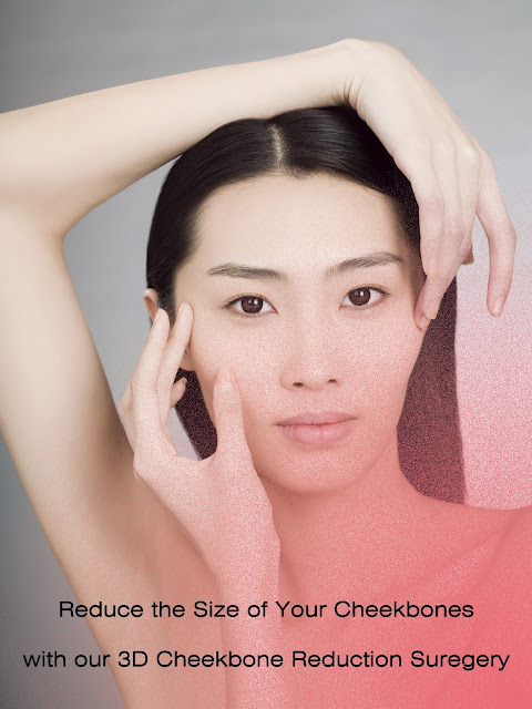 Eyelid Surgery Legend Dr. Kim Byung Gun: [BK Plastic Surgery Hosptial ...