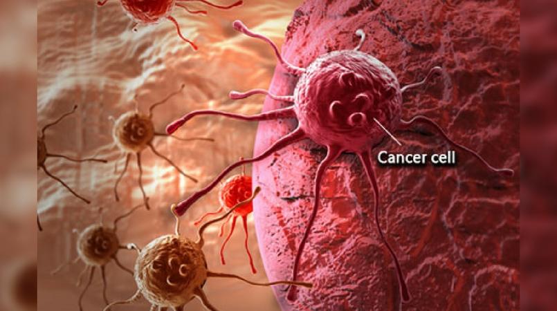 Understanding how cancer begins - PAPUA NEW GUINEA HEALTH NEWS