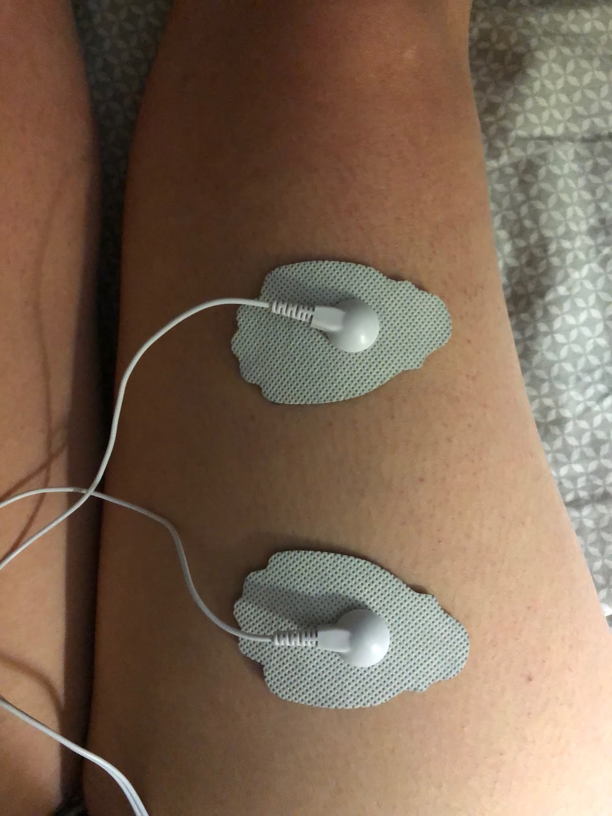 How I Use My Tens Unit from Medicpad