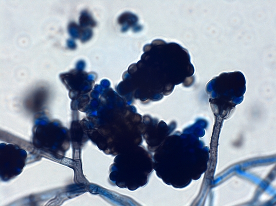 Fun With Microbiology (What's Buggin' You?): Stachybotrys species