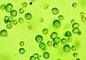 SENTHIL PRABHU SIVASAMY: Alagae, Fungi, Parasite