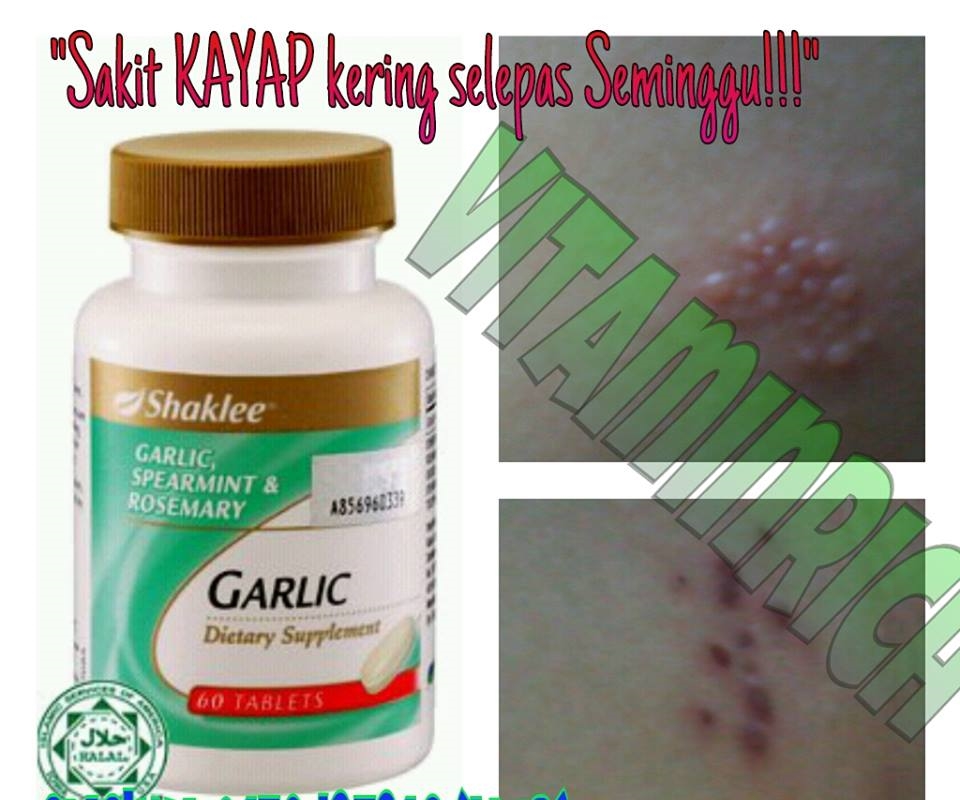 Cara Merawat Kayap dengan Lebih Berkesan dan Selamat | Suplemen Shaklee ...