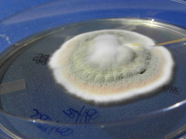 ATLAS MICOLOGIA: ASPERGILLUS VERSICOLOR