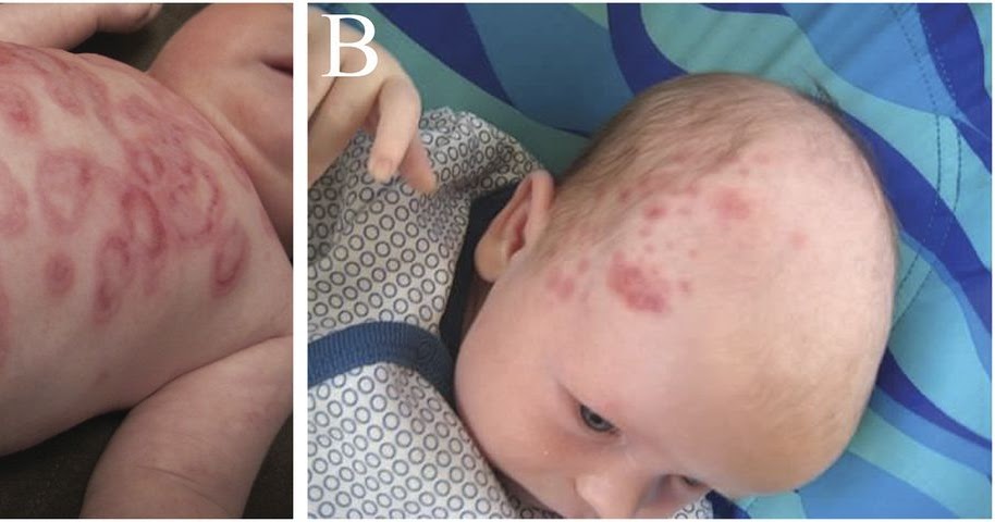 World Congress on Pediatric and Neonatal Nursing