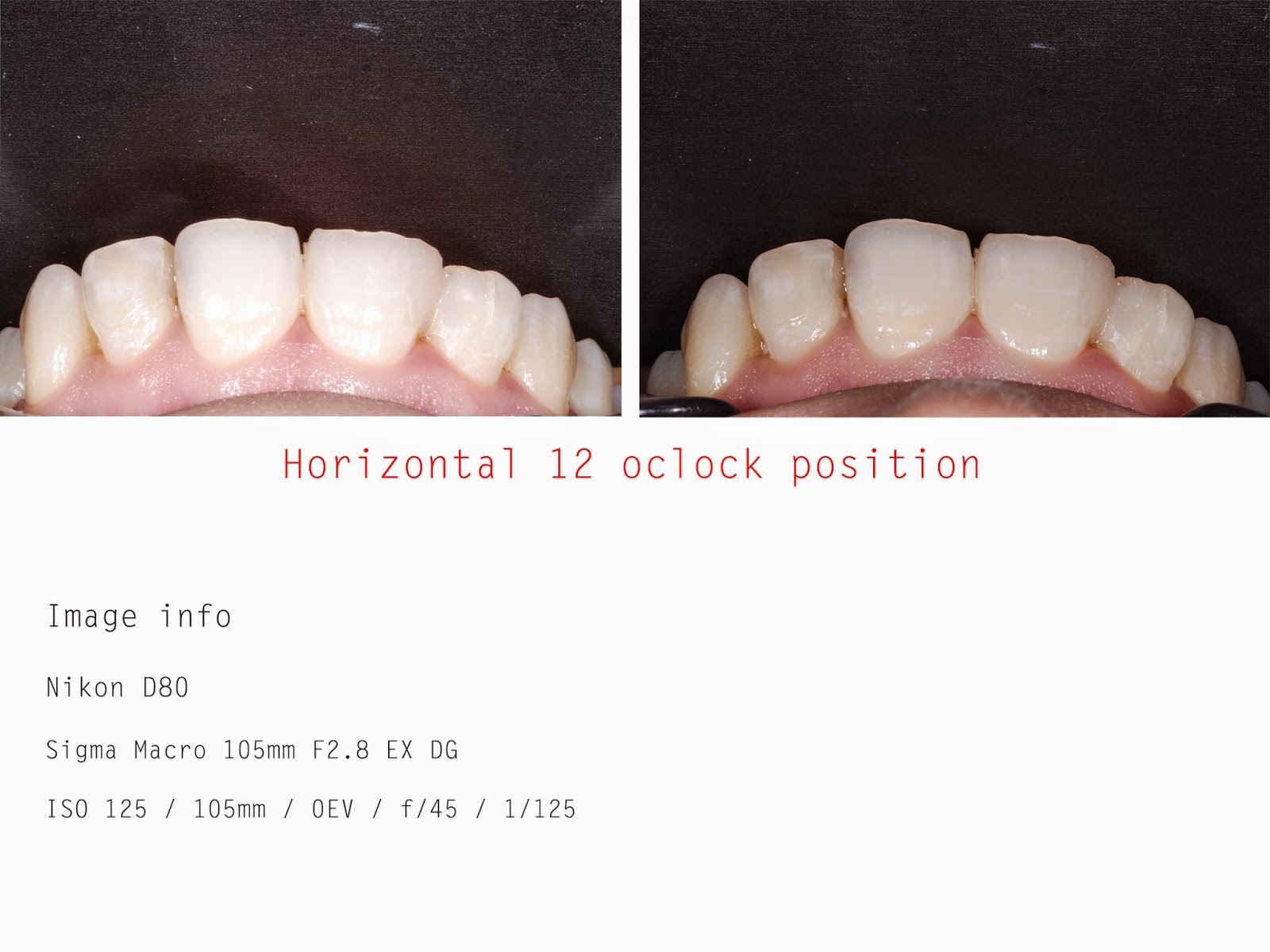 Smile Makeover & Beyond