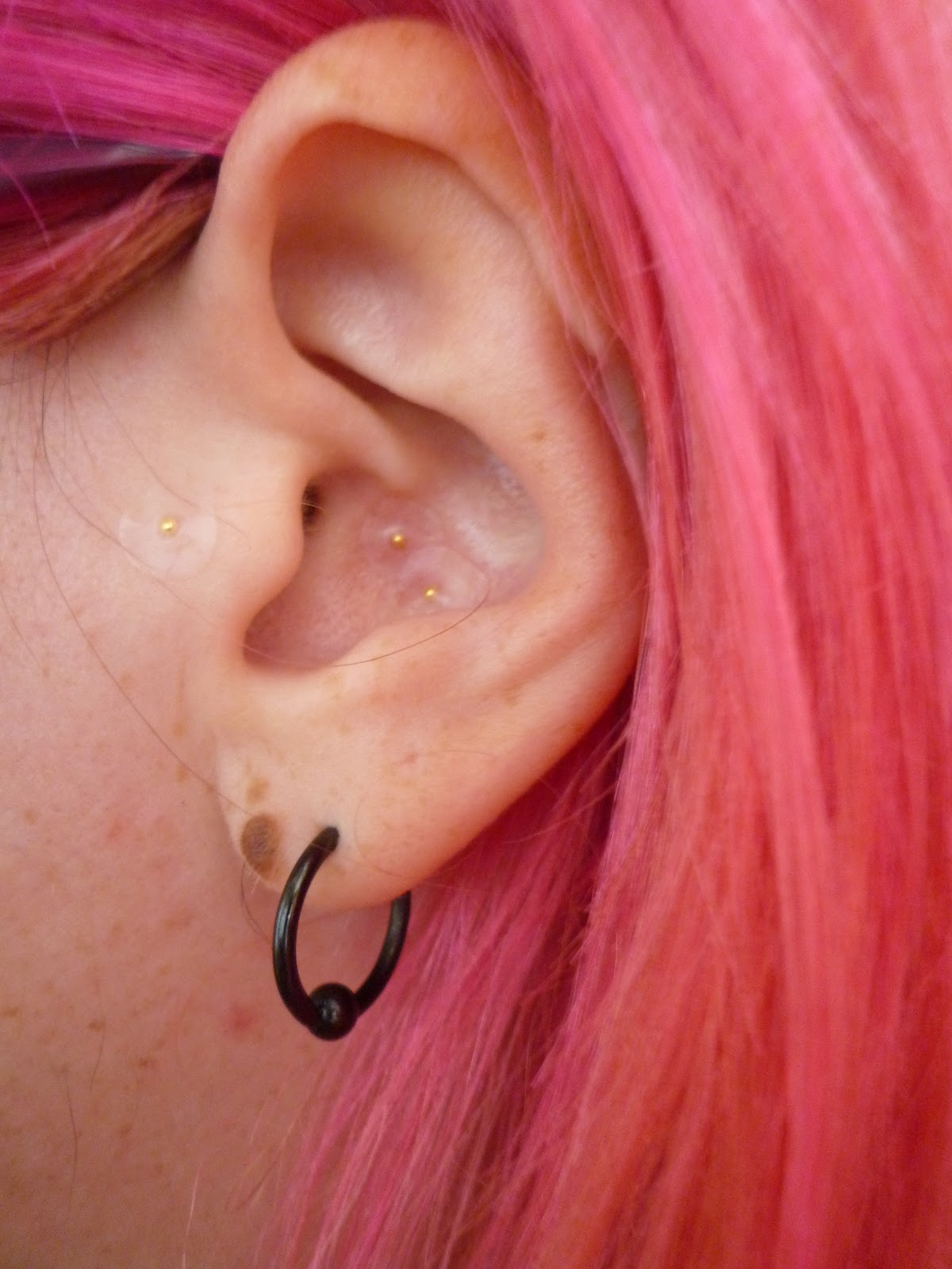 An American Mom in Japan: The Mimi-Tsubo (Ear Accupressure) Diet