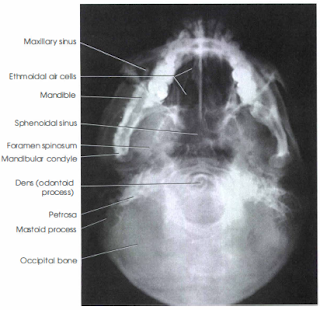 SUBMENTOVERTEX (SMV) PROJECTION: SKULL SERIES - RadTechOnDuty