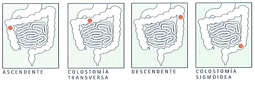 Enfermería Médico-Quirúrgica 1: diciembre 2016