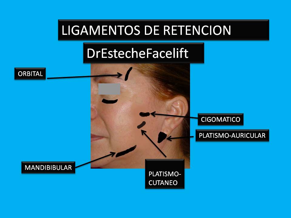 Dr.Esteche | Cirugía Plástica Facial | Cirugía Facial: CIRUGÍA PLÁSTICA ...