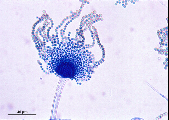 Mbbs Medicine Humanity First Microscopic Morphology Of Aspergillus