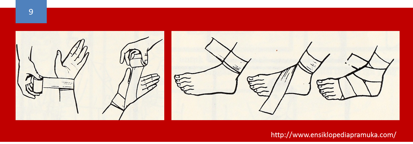 Sejarah Pramuka: PPPK : Jenis dan Cara Pembalutan