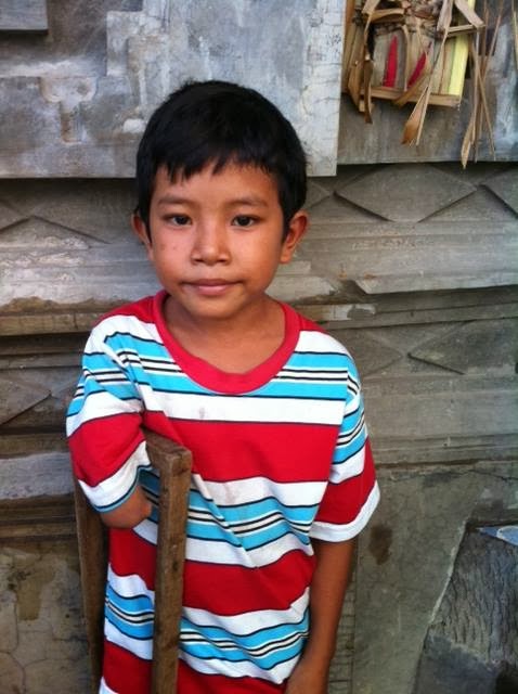 Bali Street Kids: Dana - Boy with 1 arm and 1 leg