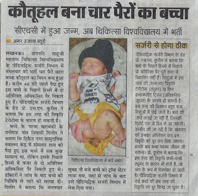 Life,films and nostalgia: 4 legged Baby Boy born at KGMC Lucknow
