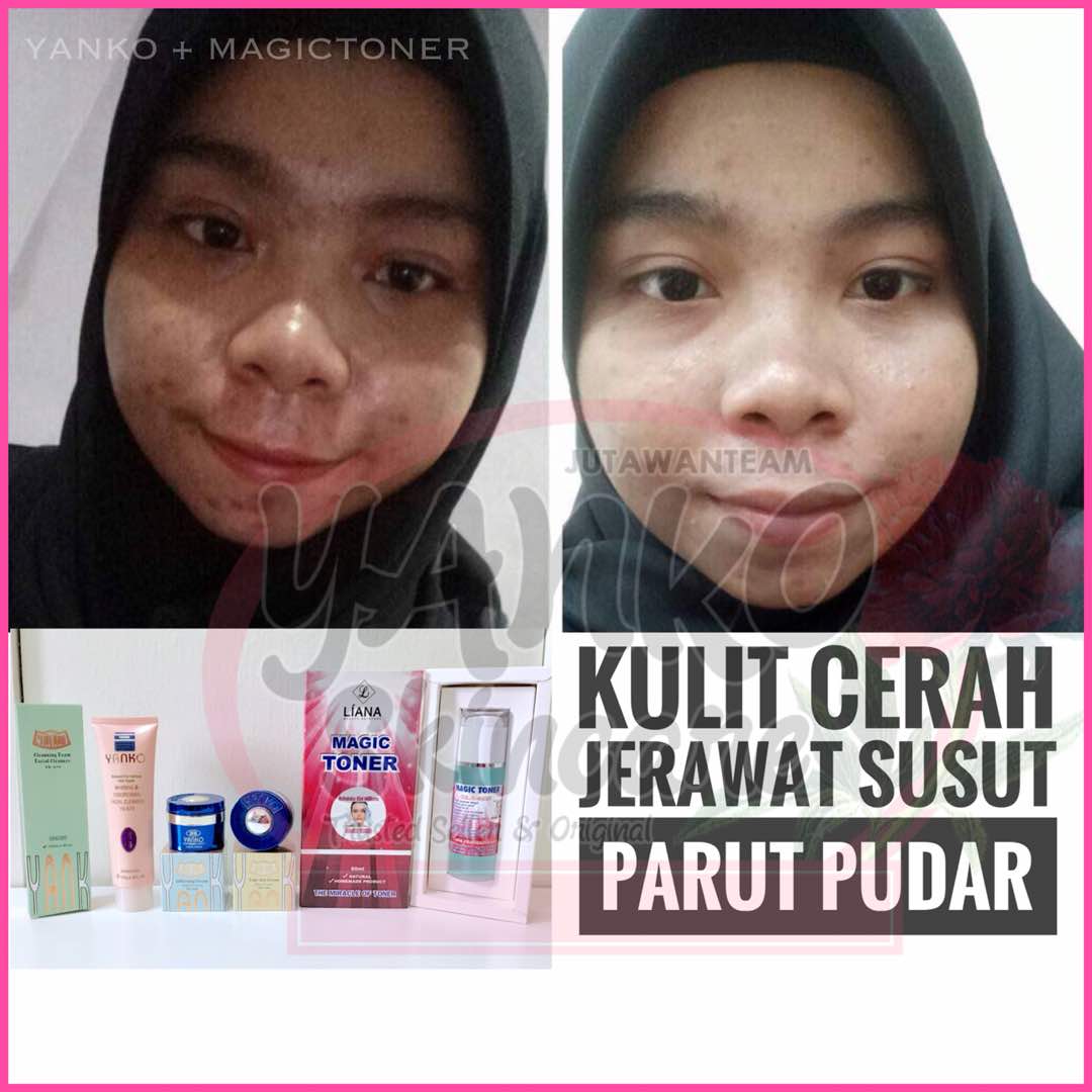 YANKO SKINCARE MALAYSIA