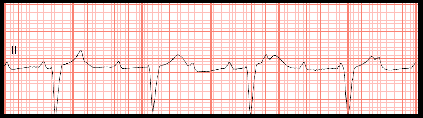 Practice EKG Strips