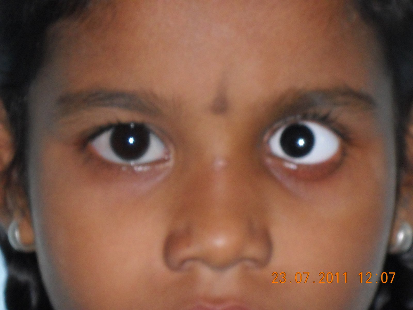 Sight to the Sightless